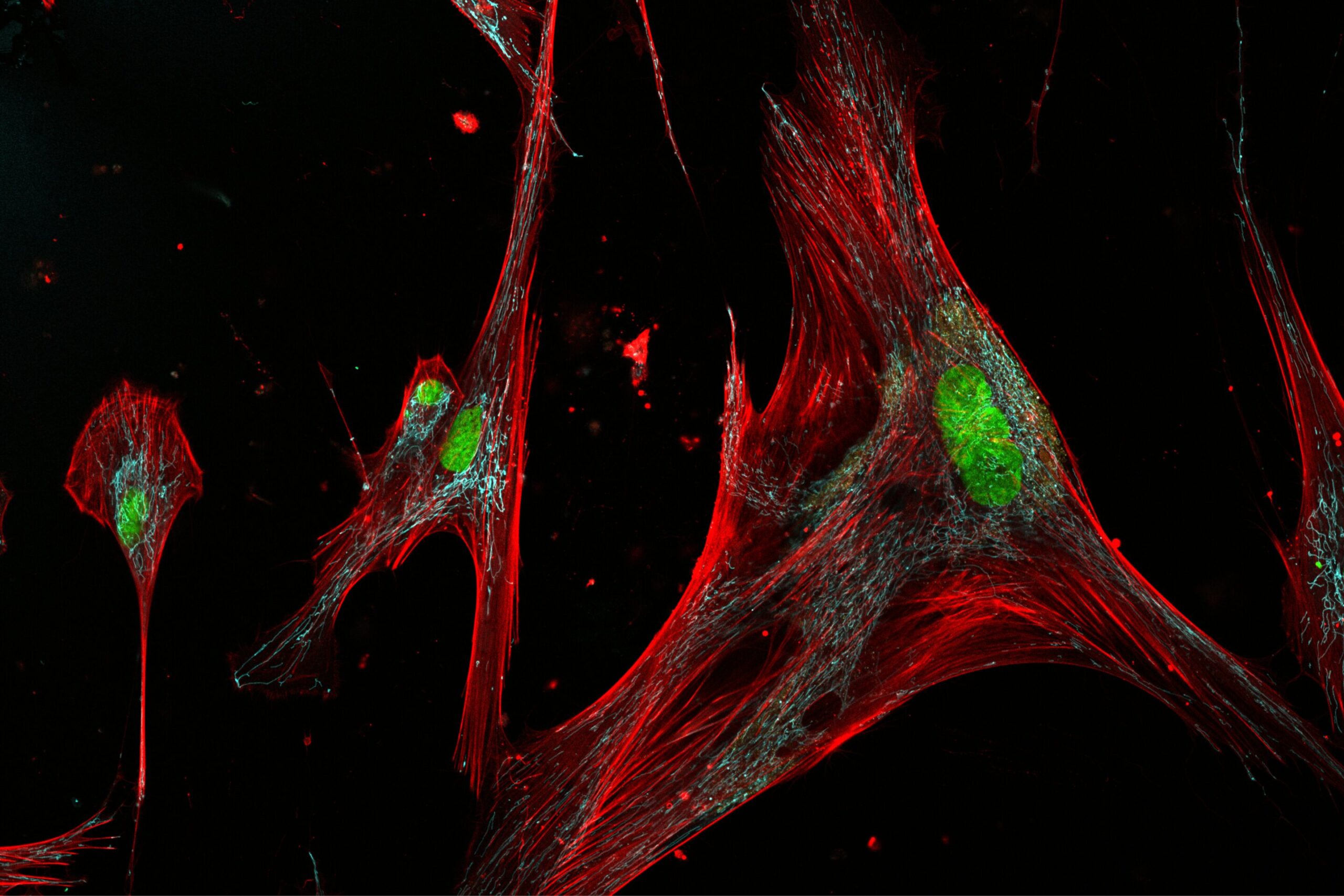 The Secret Lives of Zombie Cells
