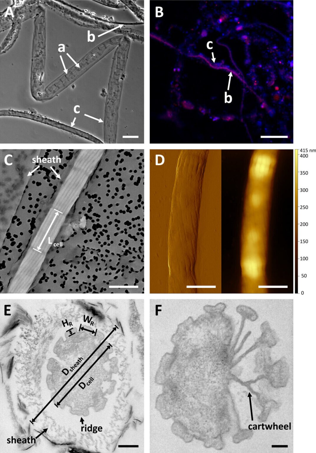 Electrifying Discovery: Scientists Unveil a New Bacterial Species That ...